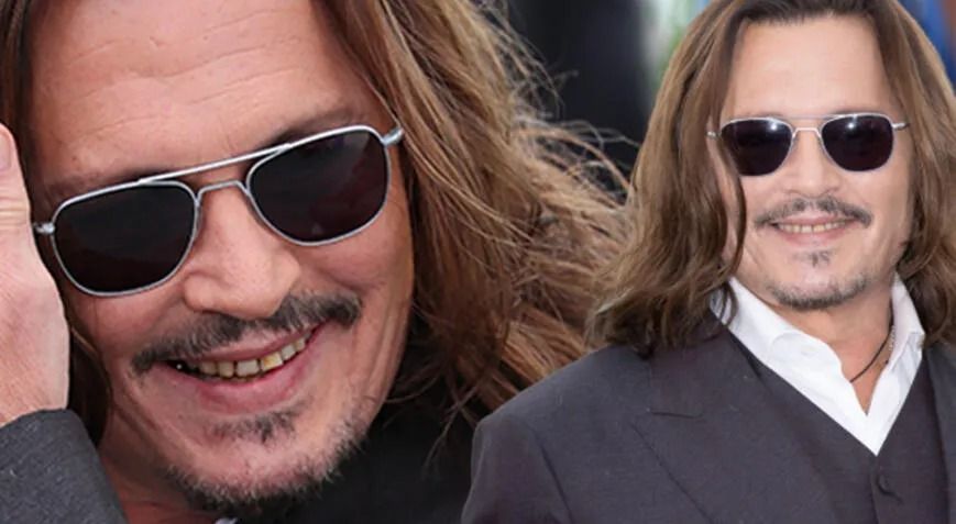 Bakupost.az - Conni Deppin dişləri gündəm oldu - FOTO